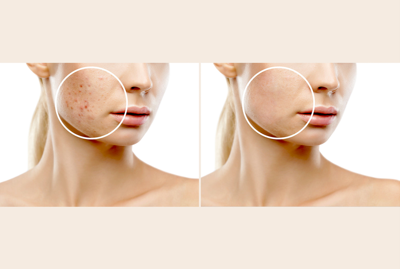 Professional Skin Scrubber