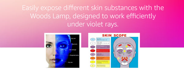 Wood's Lamp Ultraviolet Skin Diagnosis Tool (Available: first week of